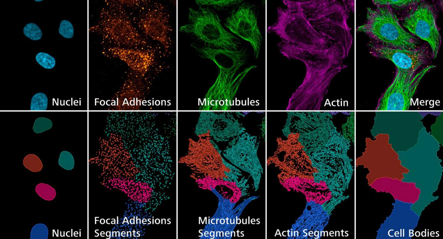 Video Demonstrates High Content siRNA Analysis Workflow | ZEISS