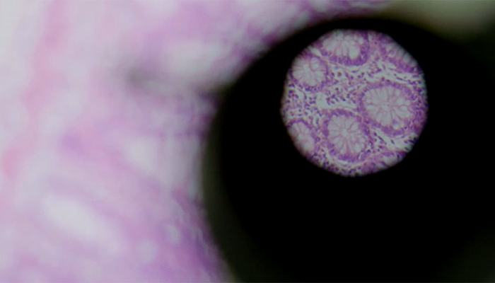How to Perform Transmitted Light Imaging