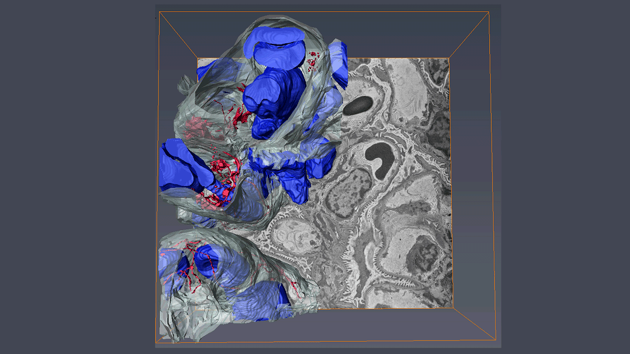 3D Ultrastructure of Kidney Glomerulus with SBF-SEM: Understanding ...