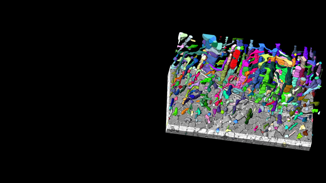 3D Volume Electron Microscopy Explores Mitochondrial and Muscle Substructure