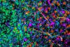 Brain Tumor Microenvironment Spatial Changes Uncovered by High-Throughput Hyperplexed ...