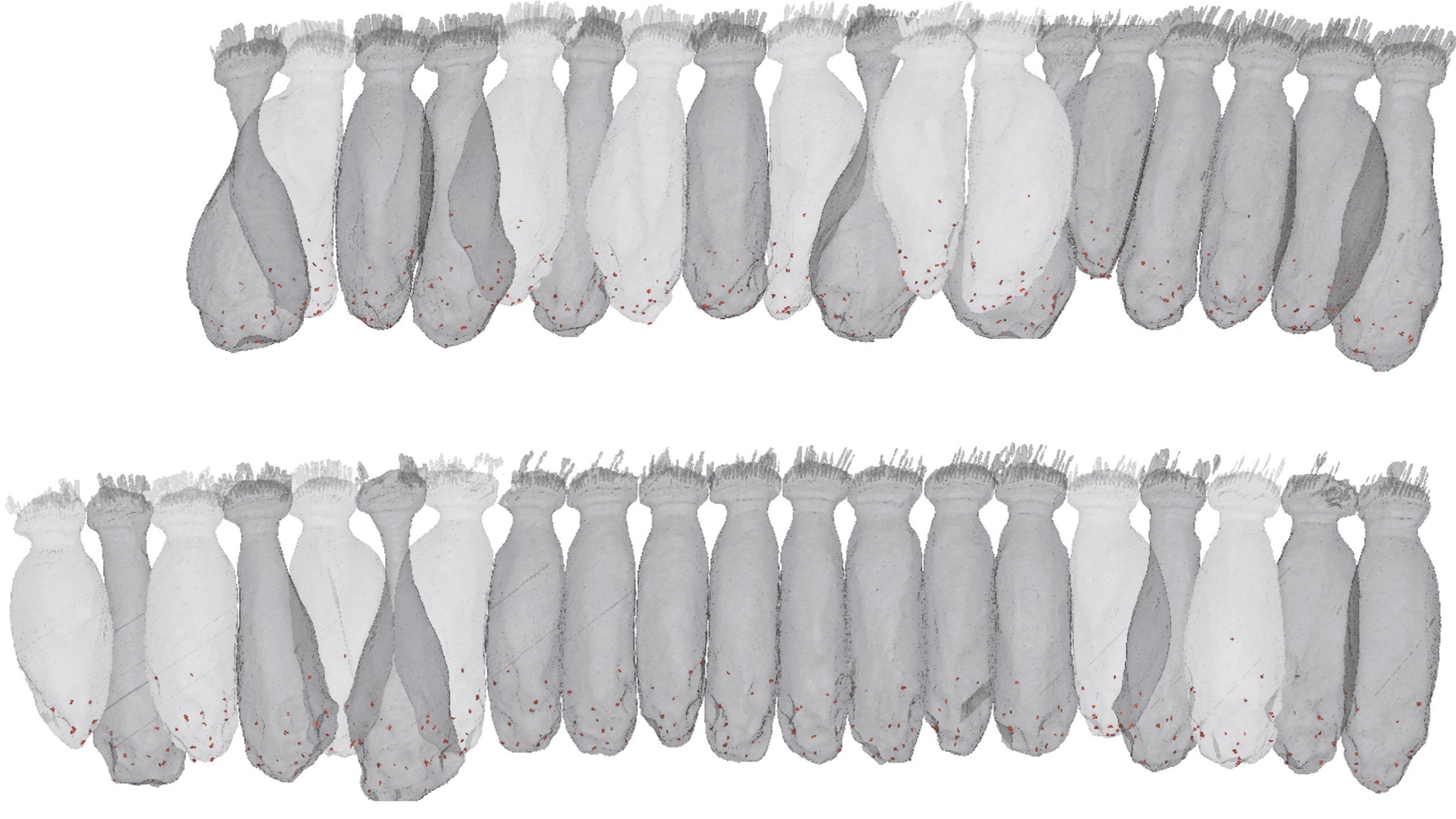 Cochlear Structures in Hearing Loss Explored with X-ray Microscopy to ...