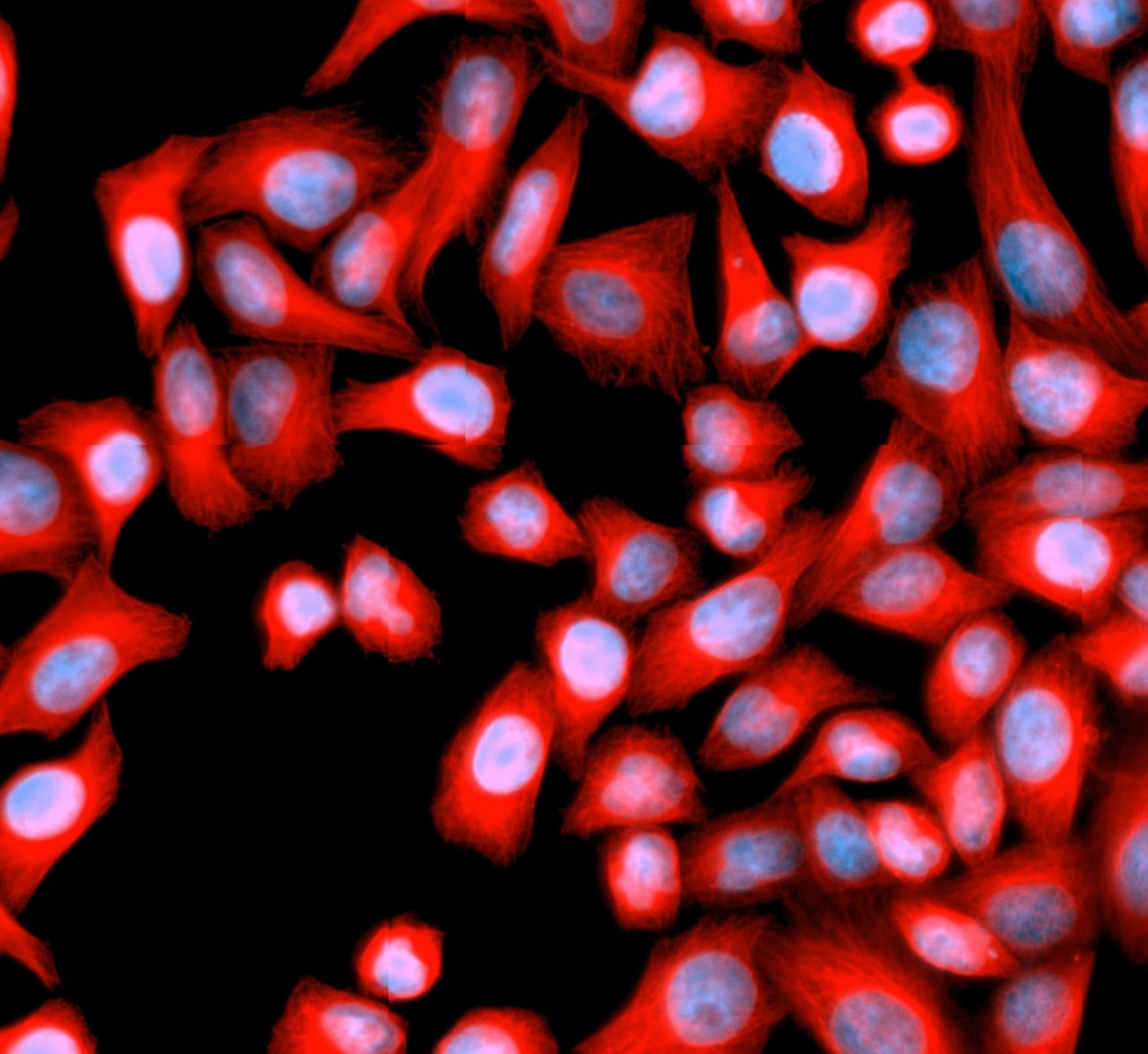 Designing Nanobodies for Viral Pandemics with Alpacas | ZEISS