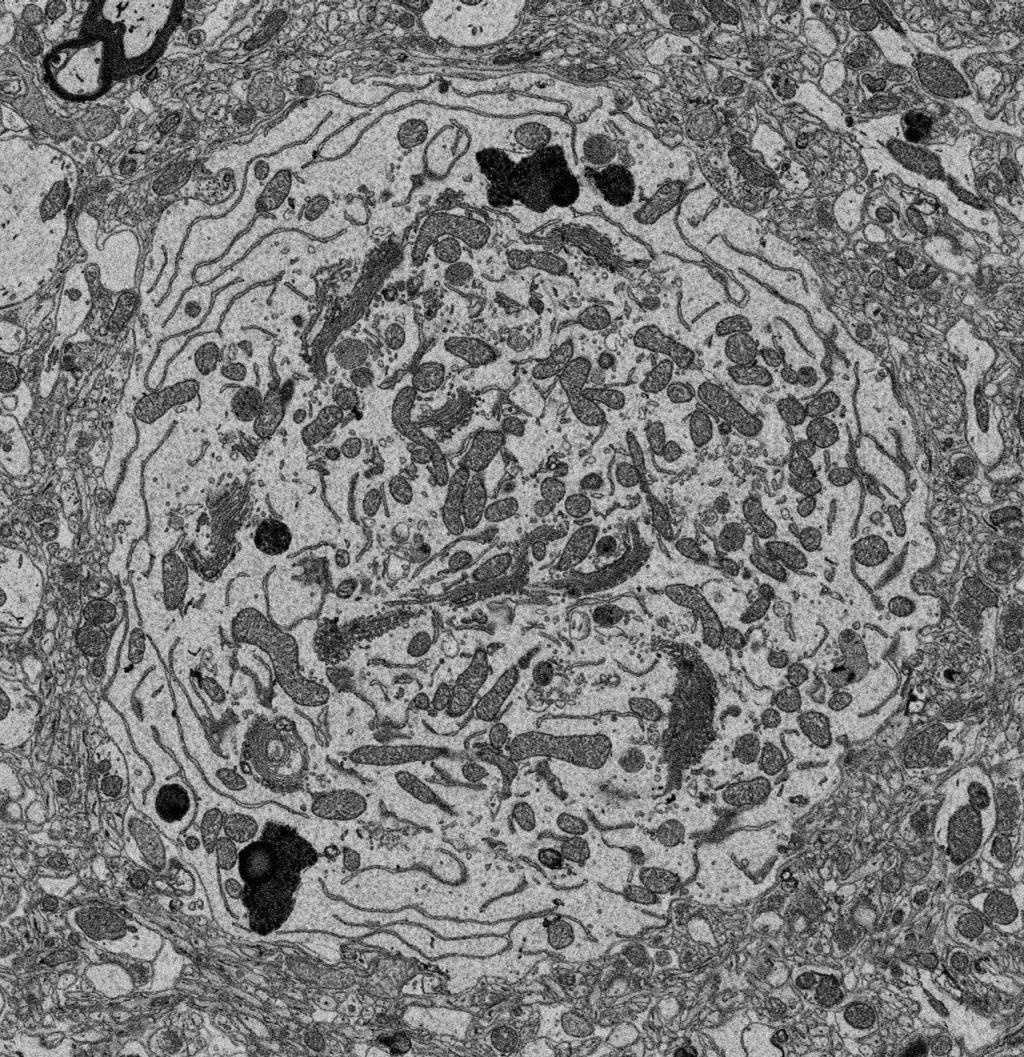 Exploring Astrocyte Morphology: How Volume Electron Microscopy is ...