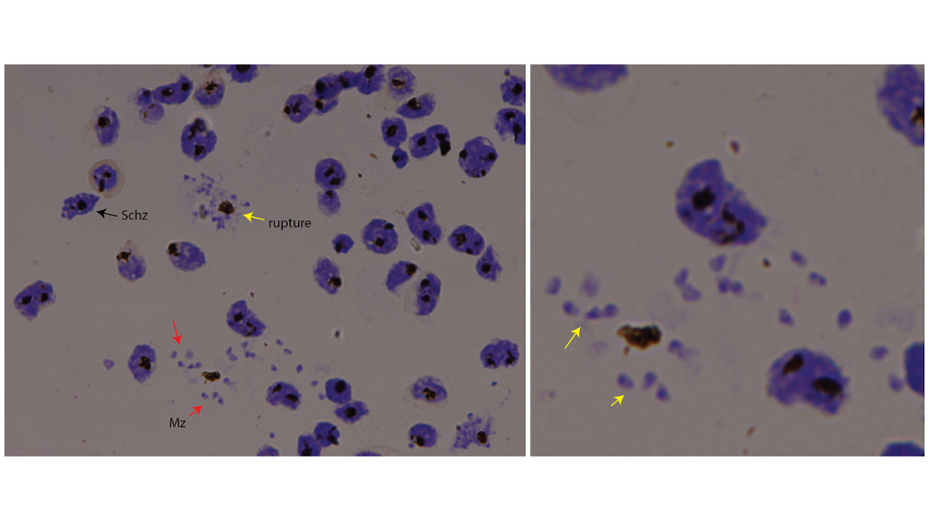 Exploring Malaria Parasite Entry into Red Blood Cells | ZEISS