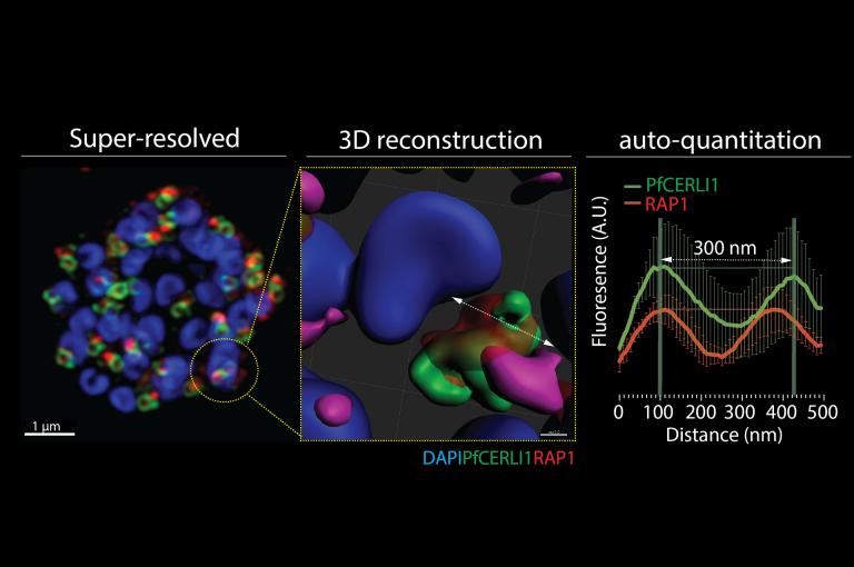Exploring Malaria Parasite Entry into Red Blood Cells | ZEISS