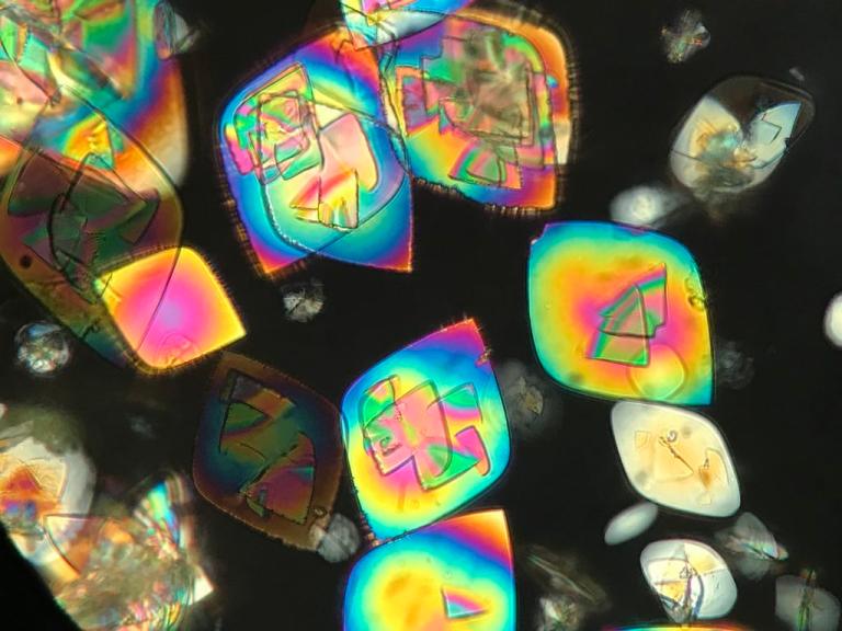 For the Love of Urinalysis