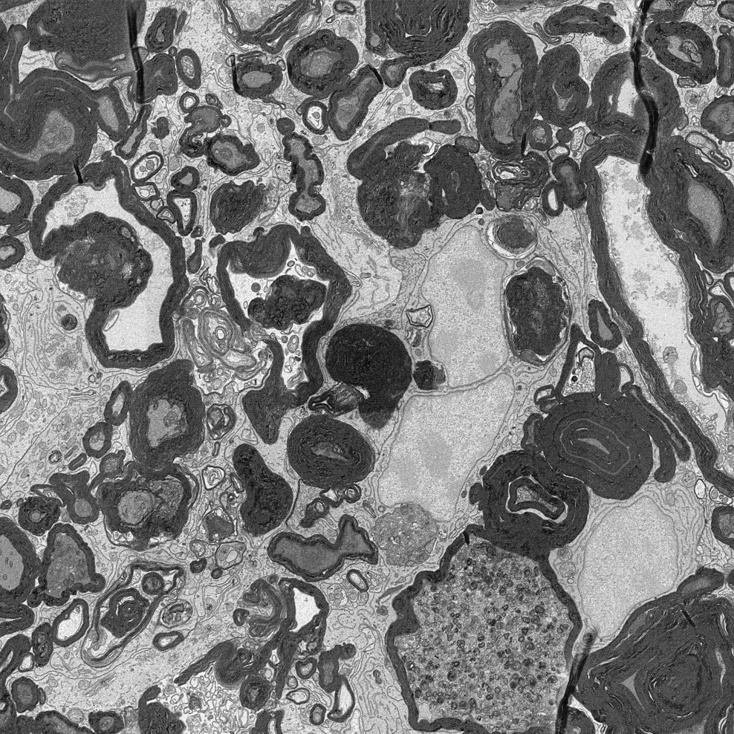 Confocal to Volume Electron Microscopy: Investigating Microglia ...