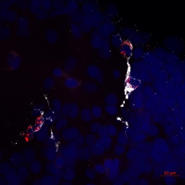Investigating Zebrafish Microglia with Confocal Microscopy | ZEISS