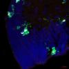 Investigating Zebrafish Microglia with Confocal Microscopy | ZEISS
