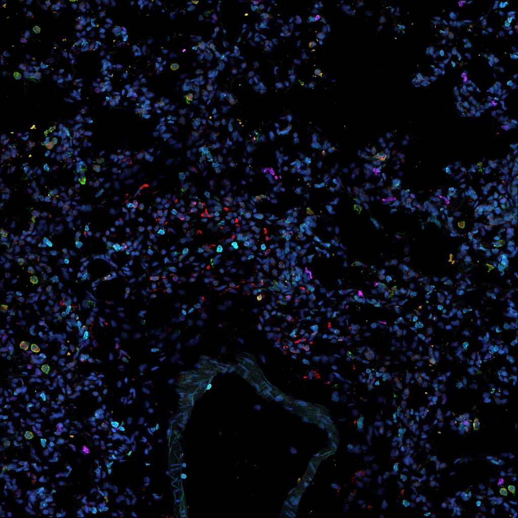 Spatial Biology Studies in Lung Tissue using Spectral Microscopy | ZEISS