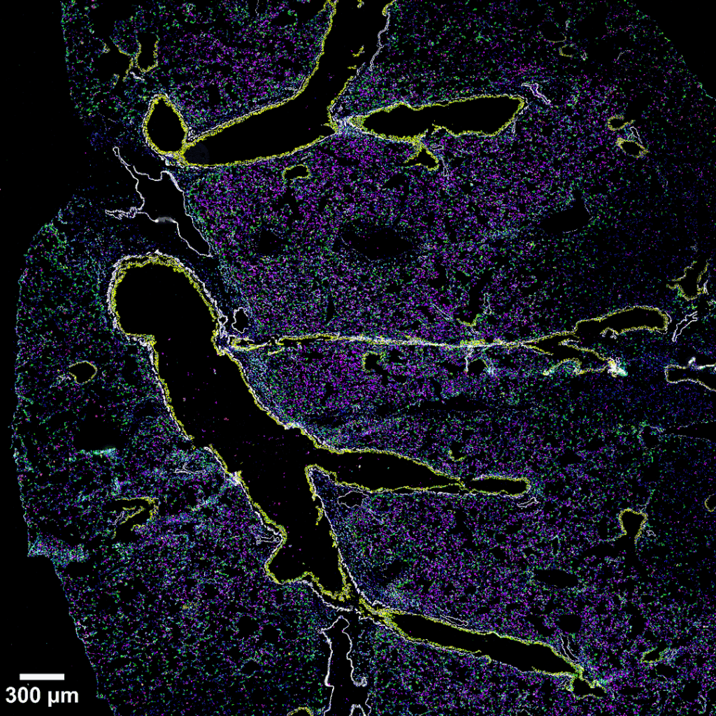 The Intricate Network of Immune Cells Revealed by Multiplex Tissue ...