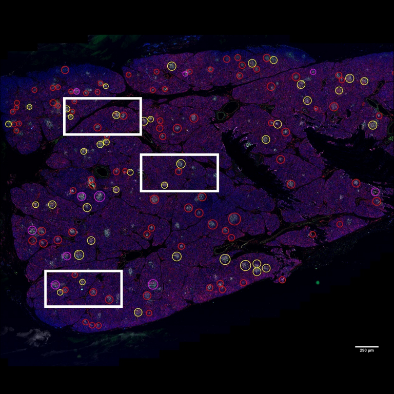 Whole Slide Imaging of the Pancreas to Study Type 1 Diabetes | ZEISS