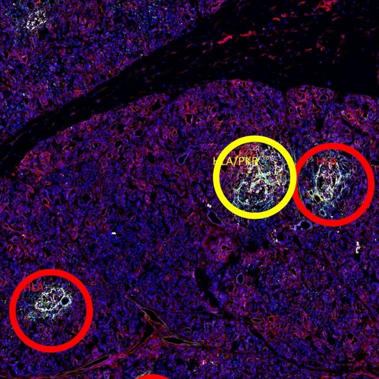 Whole Slide Imaging of the Pancreas to Study Type 1 Diabetes | ZEISS