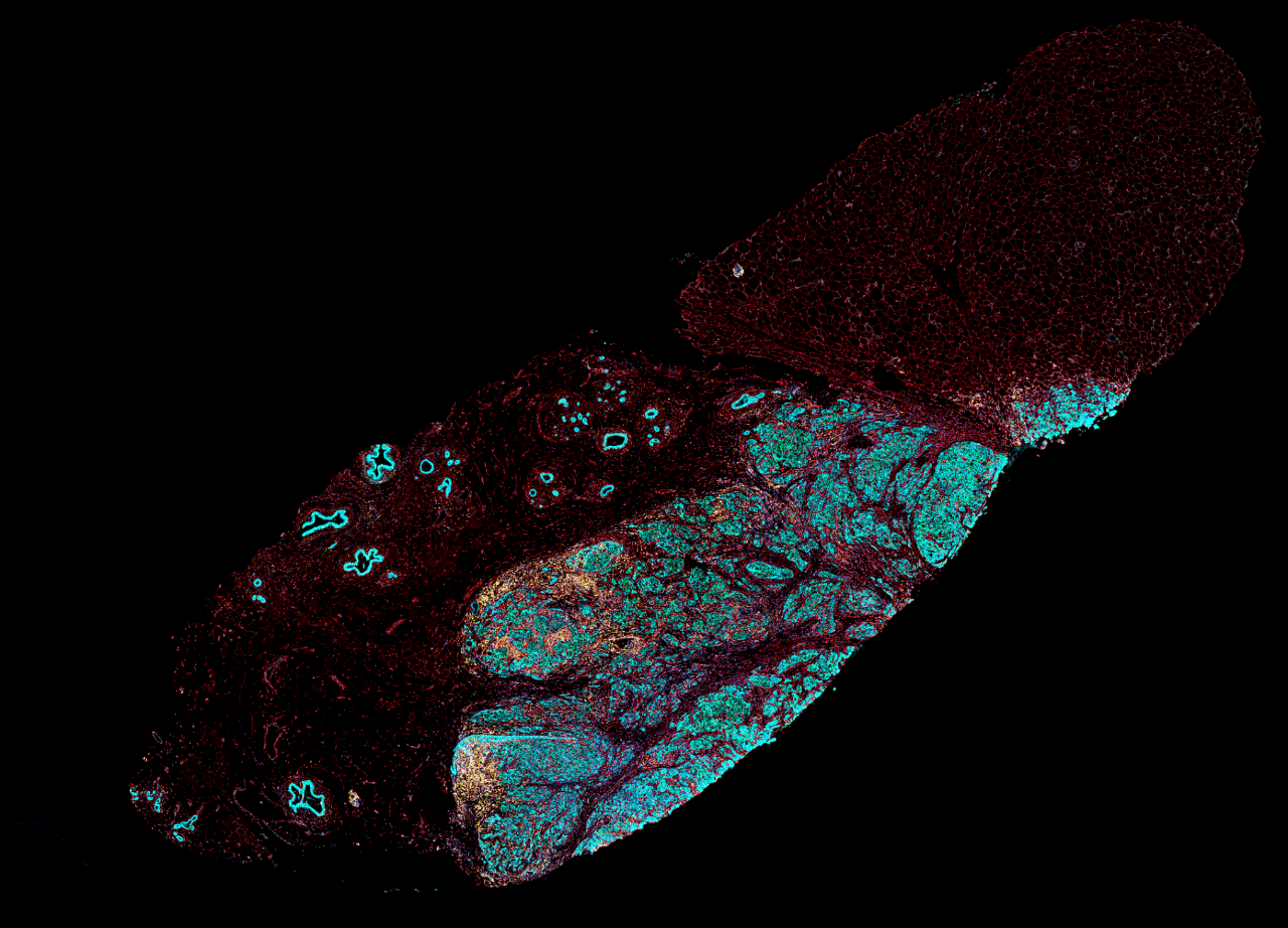7 Color Multiplex Immunofluorescence For Spatial Biology With A Digital Slide Scanner