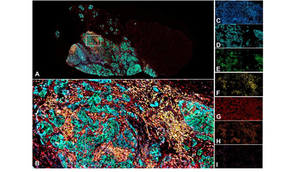 7 Color Multiplex Immunofluorescence for Spatial Biology with a Digital ...