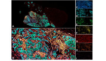 7 Color Multiplex Immunofluorescence for Spatial Biology with a Digital ...
