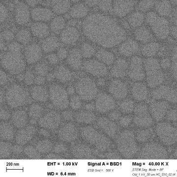 ZEISS FE-SEM Upgrades