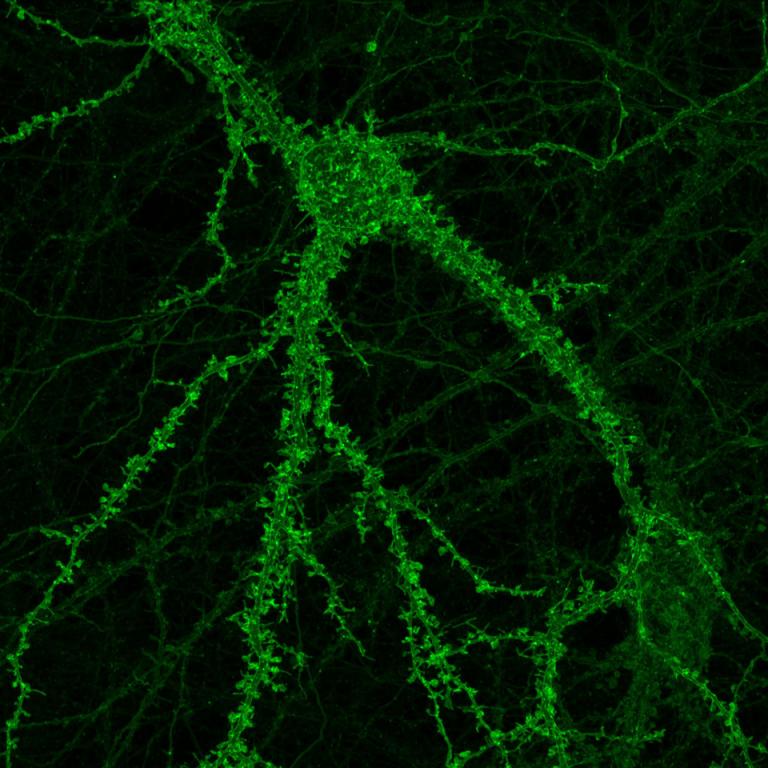 ZEISS Upgrades for Laser Scanning Microscopy