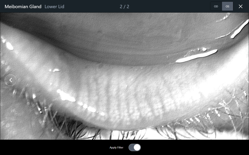 ZEISS VISUREF 600 | Vision analysis and pre-test