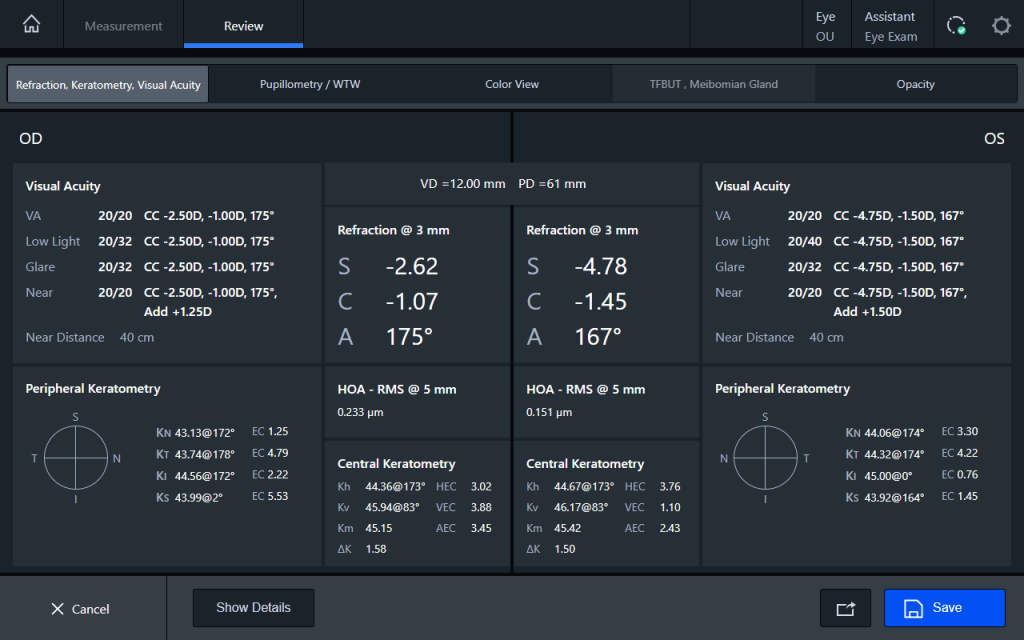 ZEISS VISUREF 600 | Vision analysis and pre-test