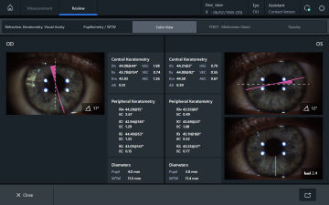 ZEISS VISUREF 600 | Vision analysis and pre-test