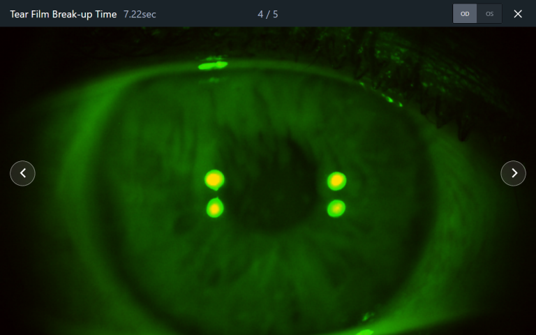 ZEISS VISUREF 600 | Vision analysis and pre-test