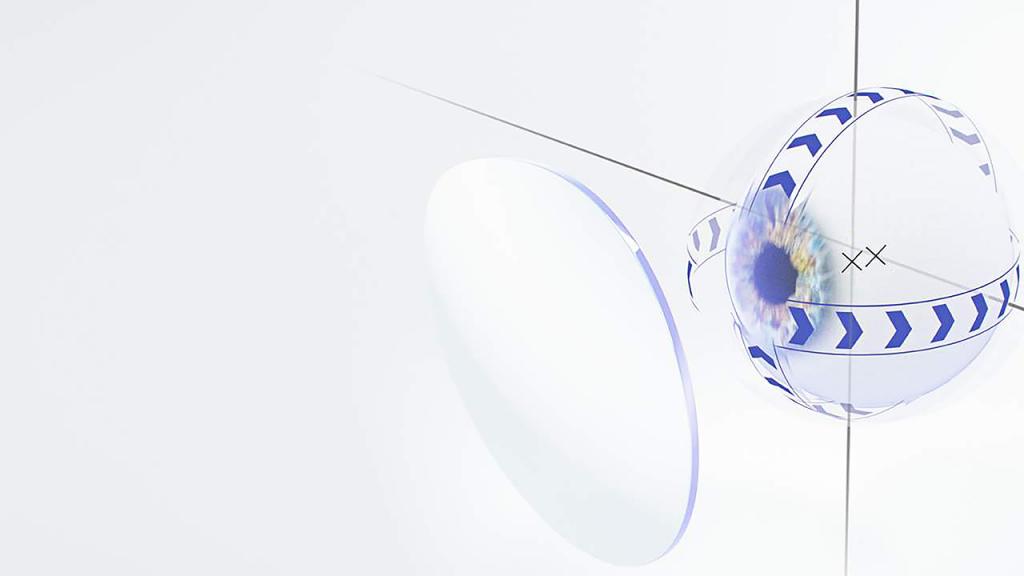 ZEISS SmartView 2.0 technology