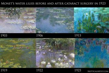 The Vision of Monet: UV Protection, Cataracts and ZEISS lenses