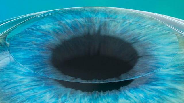 LASIK - Laser Eye Surgery