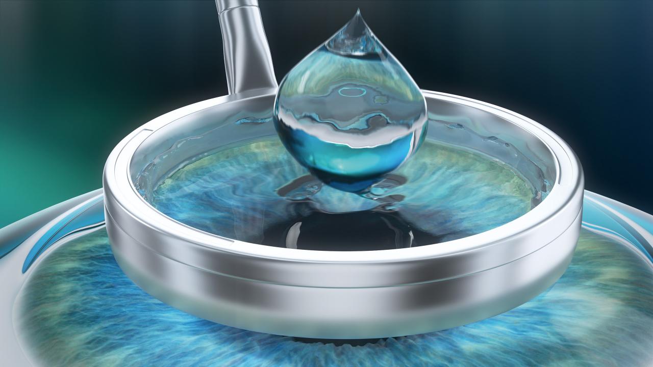 Our guide to PRK laser vision correction | ZEISS