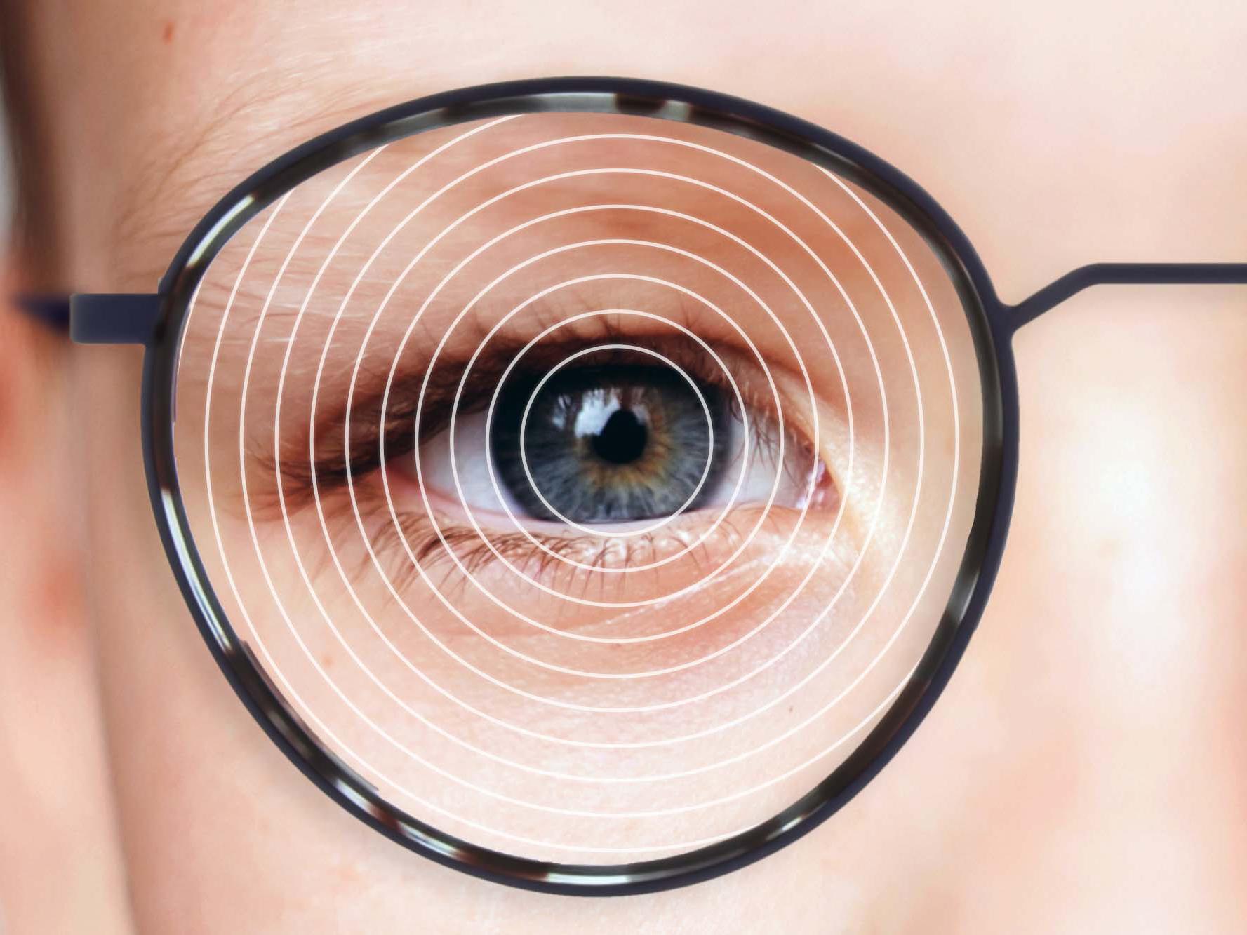 ZEISS Myopia management lenses